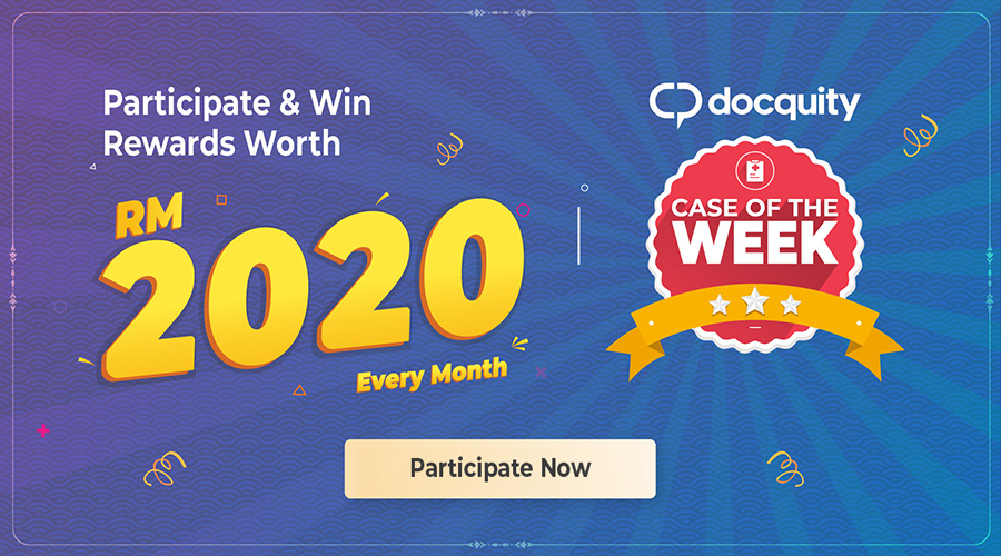 Post and Win - Is your Case challenging enough?