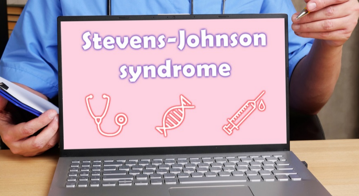 Stevens-Johnson Syndrome / Toxic Epidermal Necrolysis Updated ...